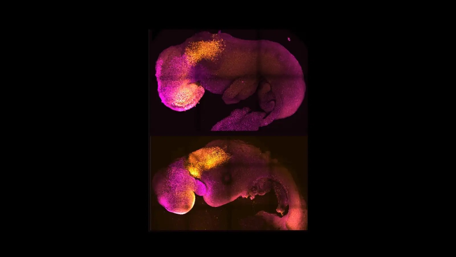Saintis Menghasilkan Embryo Dari Sel Tunjang Tanpa Menggunakan Sperma ...